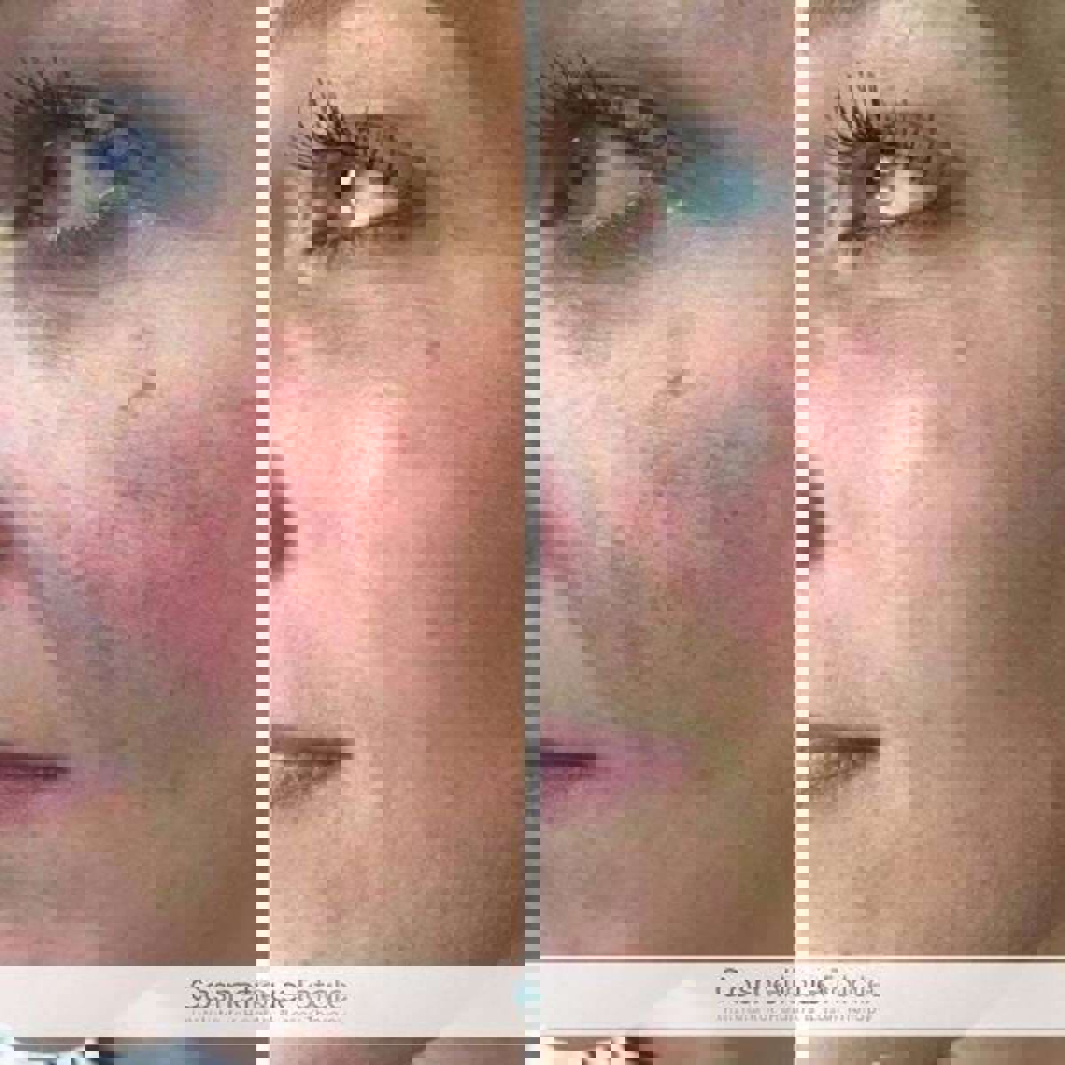 Behandlungsergebnisse | Cosmetique Totale