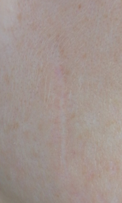 Behandelingen en Resultaten | Cosmetique Totale