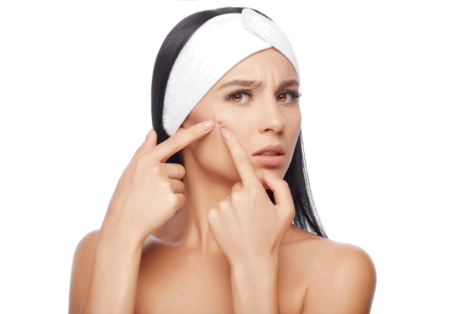 Causes de l'acné | Traitement de l'acné