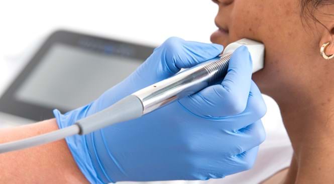 Laser fractionné | Fractora, Morpheus, laser Ematrix