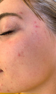 Cosmetique Totale | Huidtherapie Kliniek